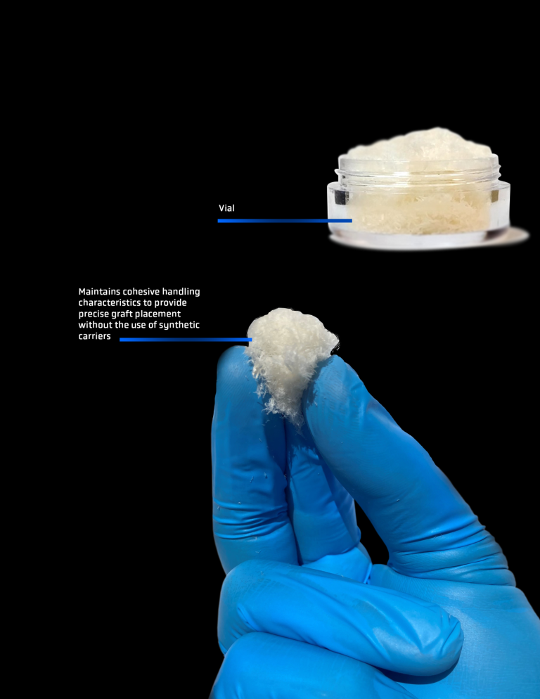 Cortical Fibers | Ossify™ 100% DBM Putty