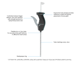 Bone Graft Delivery | SurGenTec Graftgun®
