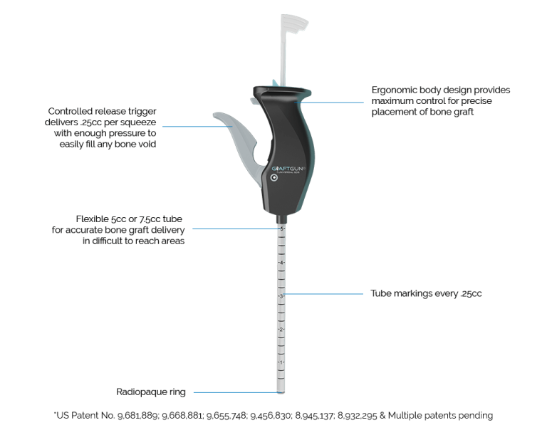 Bone Graft Delivery | SurGenTec Graftgun®