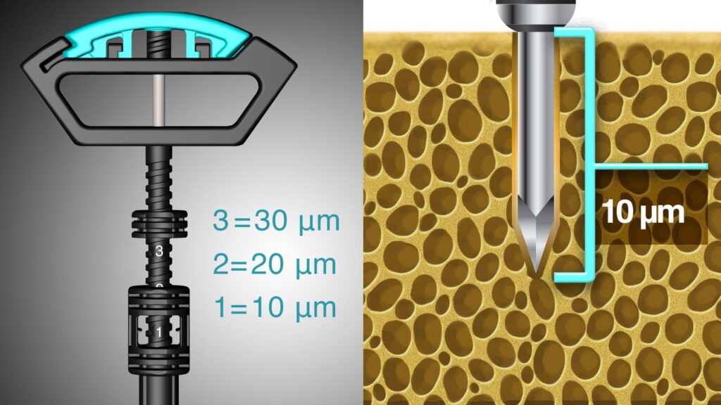 SURGENTEC - ALARA Needle