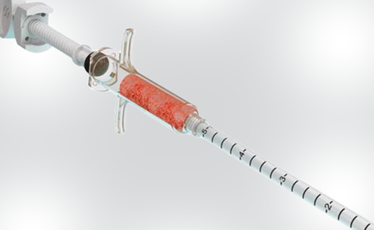 Bone Graft Delivery | SurGenTec Graftgun®