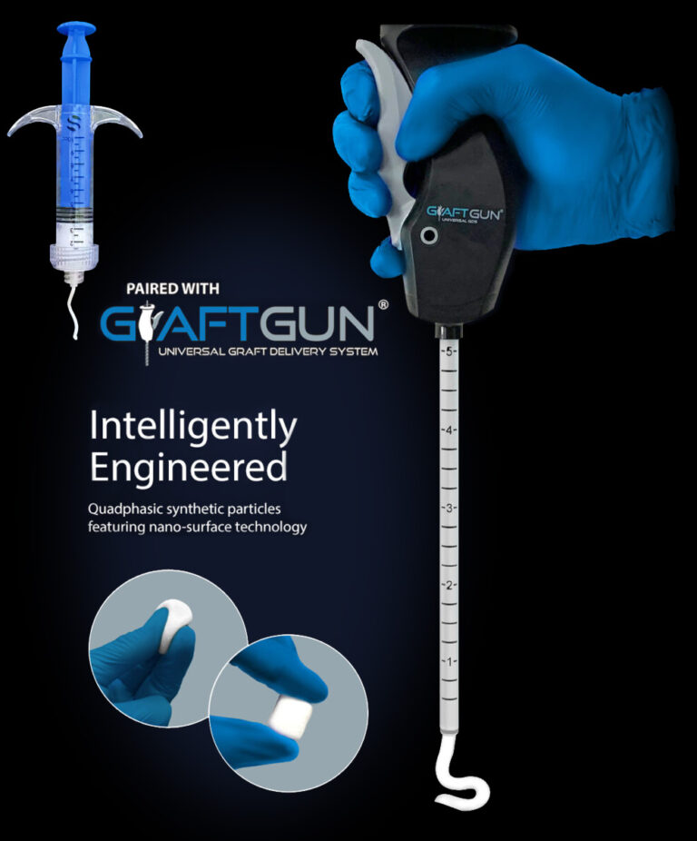 Synthetic Bone Graft Putty | OsteoFlo® NanoPutty®