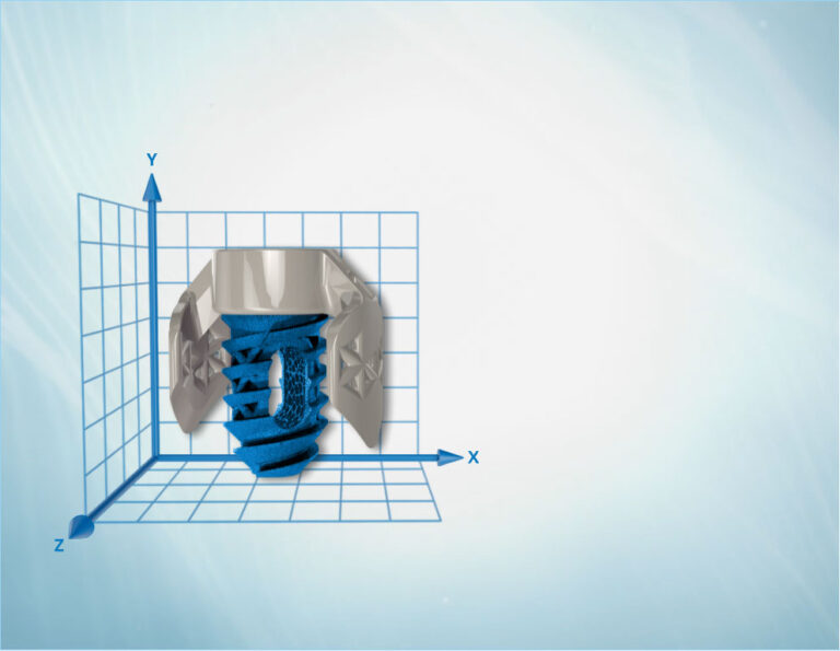TILINK-P: SI Fusion Implant System