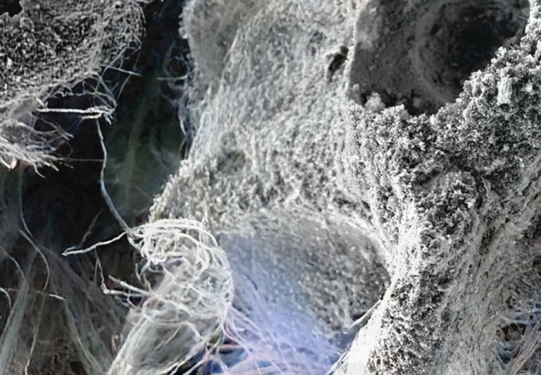 OsteoFlo® HydroFiber™ - SurGenTec Graftgun®